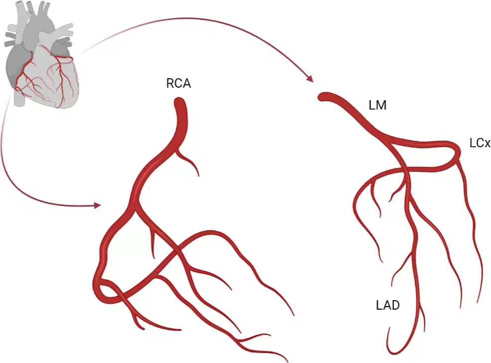 RCA - Right coronary artery